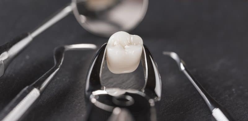 Do's & Don'ts After Tooth Extraction | Ora Dental | Blog